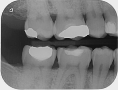 Dental X-Rays, Do I Really Need Them? - Clinique DMD